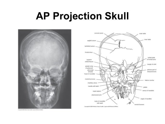 Head & neck rs x-rays