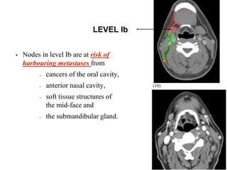 Head n neck nodal delineation ppt | PPTX