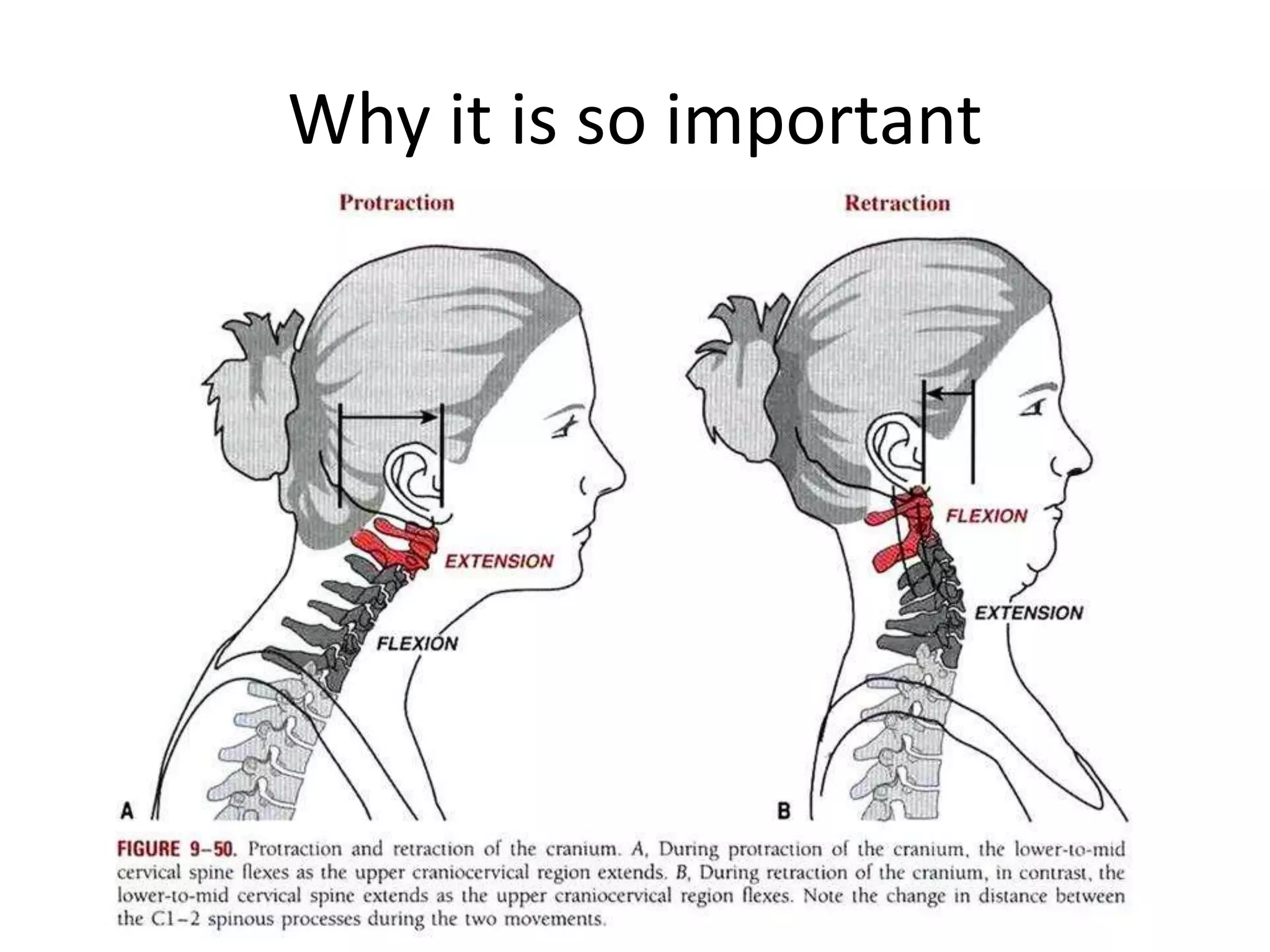 Head retraction | PPT