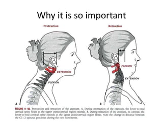 Head retraction | PPTX