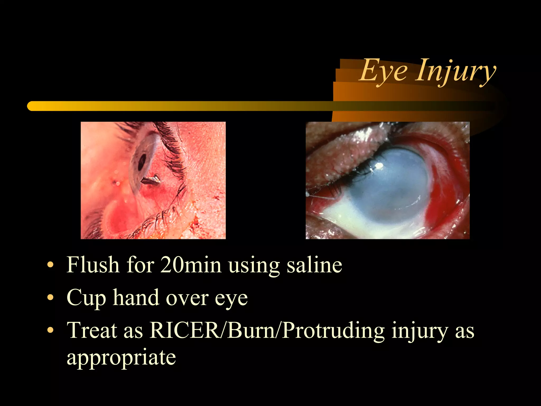 Senior First Aid: Head Spinal Thermal Eye Chest Chocking | PPT