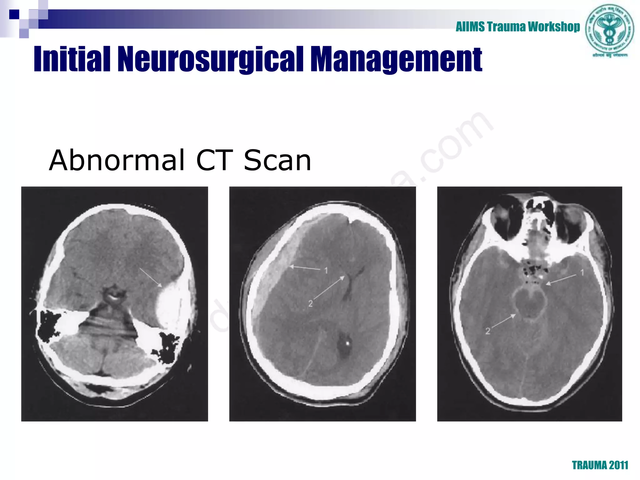 Head and Spine trauma traumacon 2011.ppt