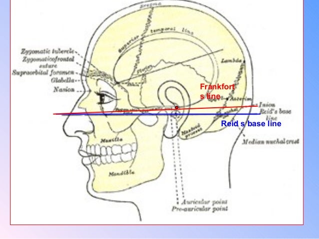 Head surface anatomy