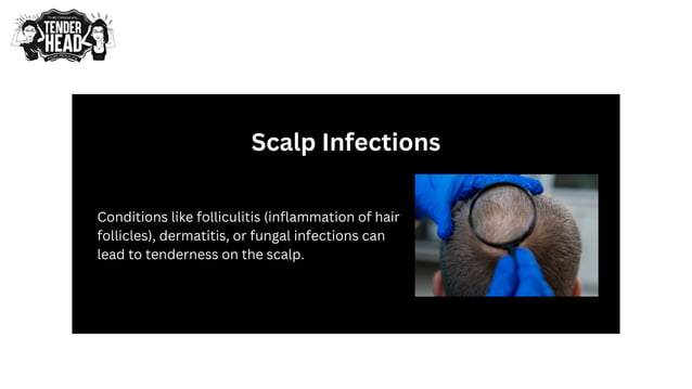 Head Tenderness - The Original Tender Head | PDF | Brain and Nervous ...