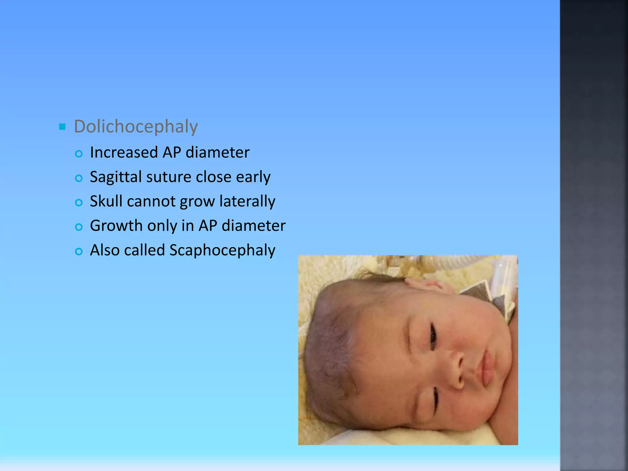 Head to foot examination in Paediatrics | PPTX