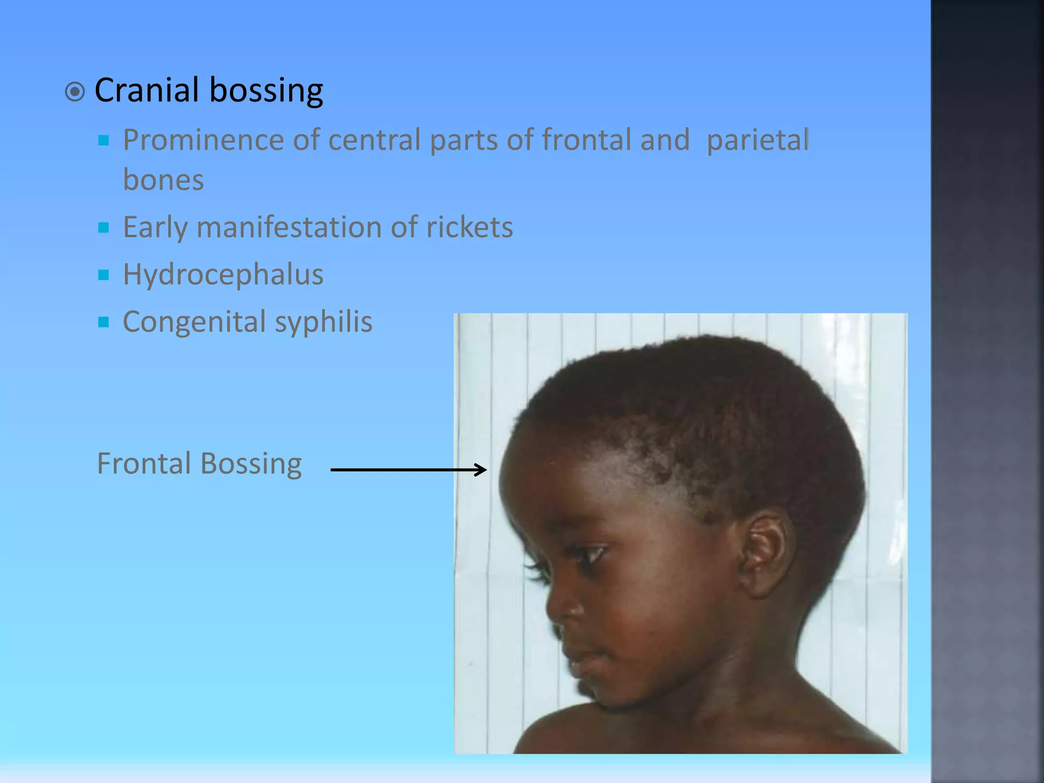 Head to foot examination in Paediatrics | PPTX