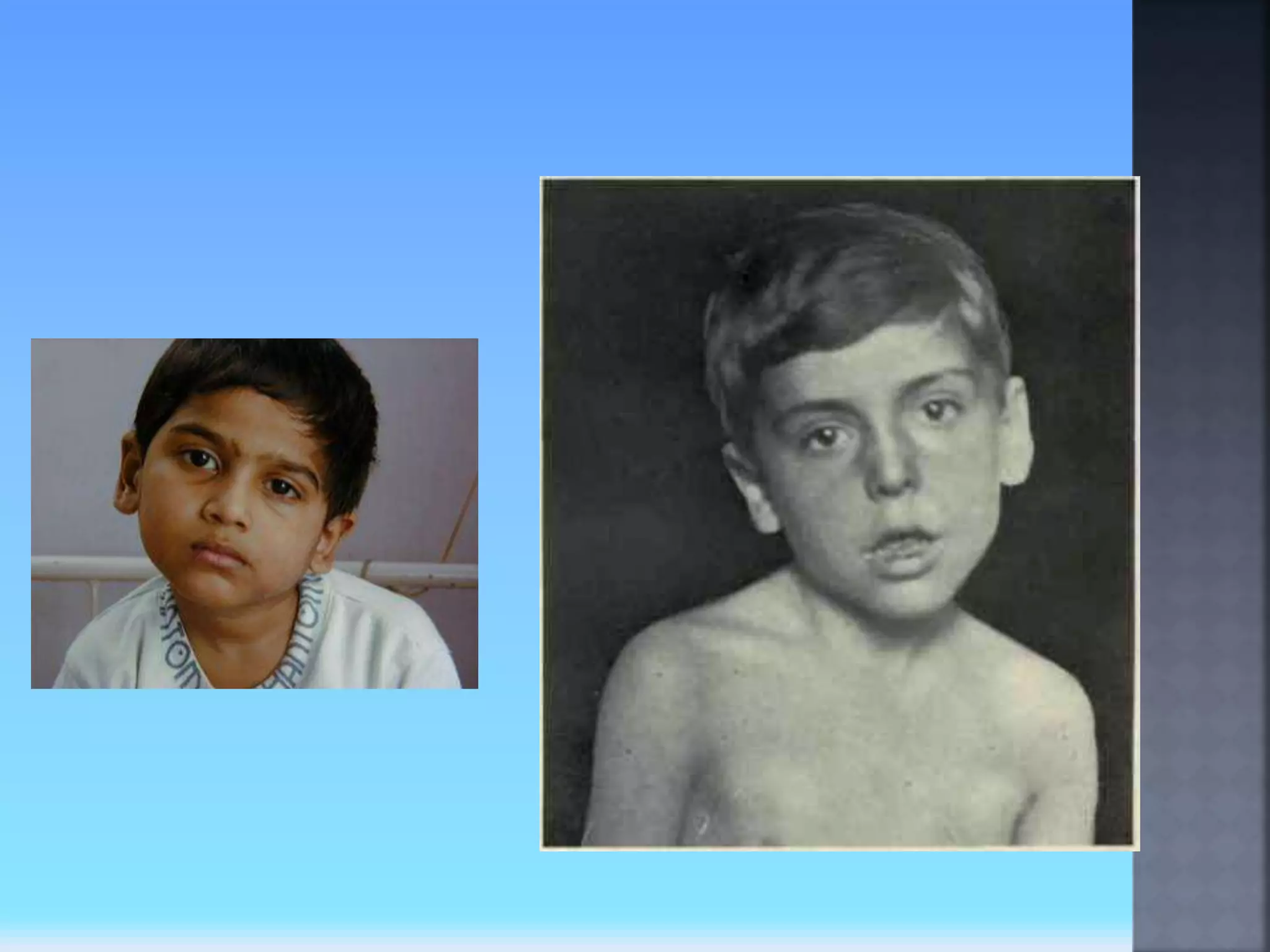 Head to foot examination in Paediatrics | PPTX