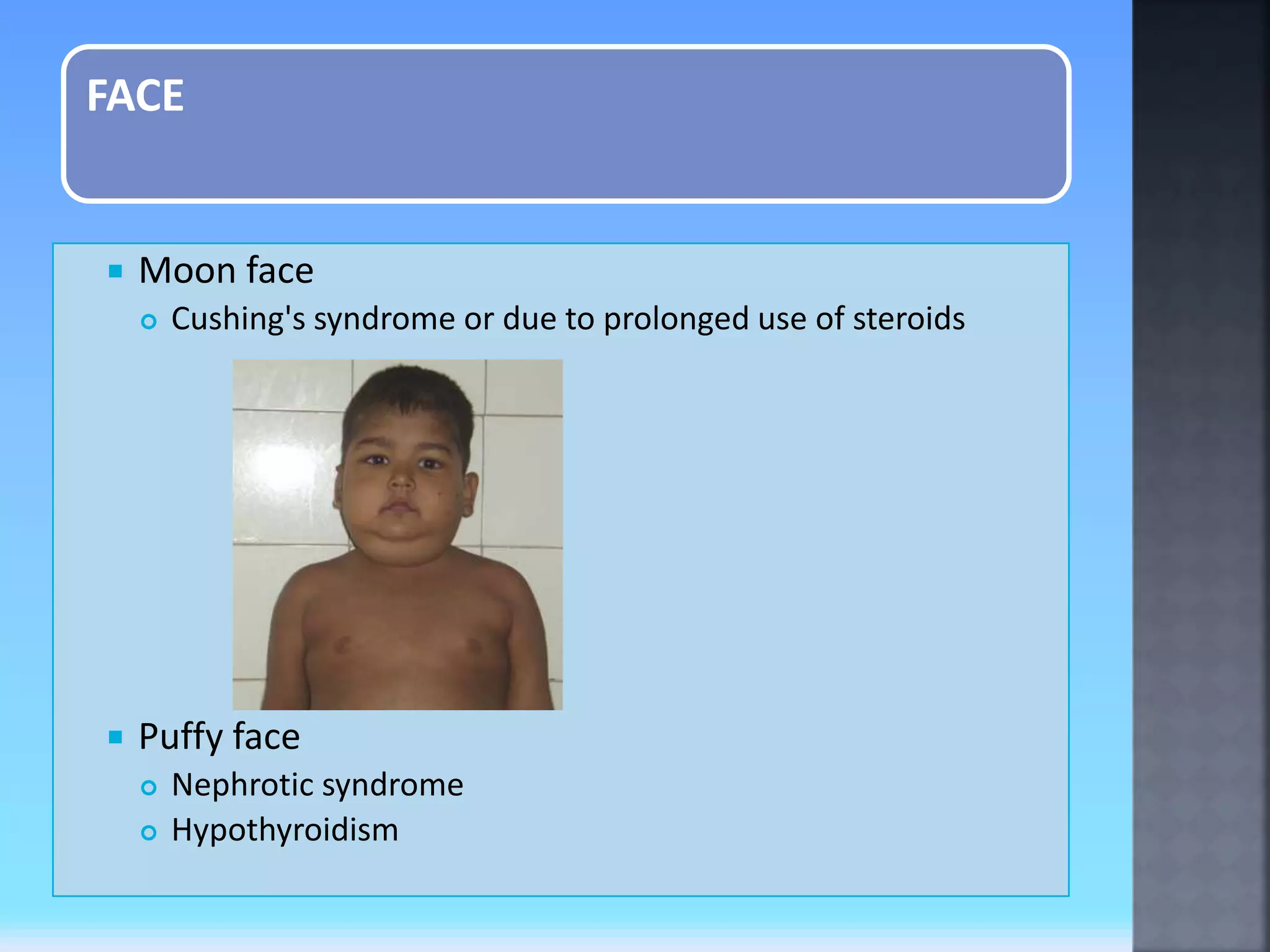 Head to foot examination in Paediatrics | PPTX