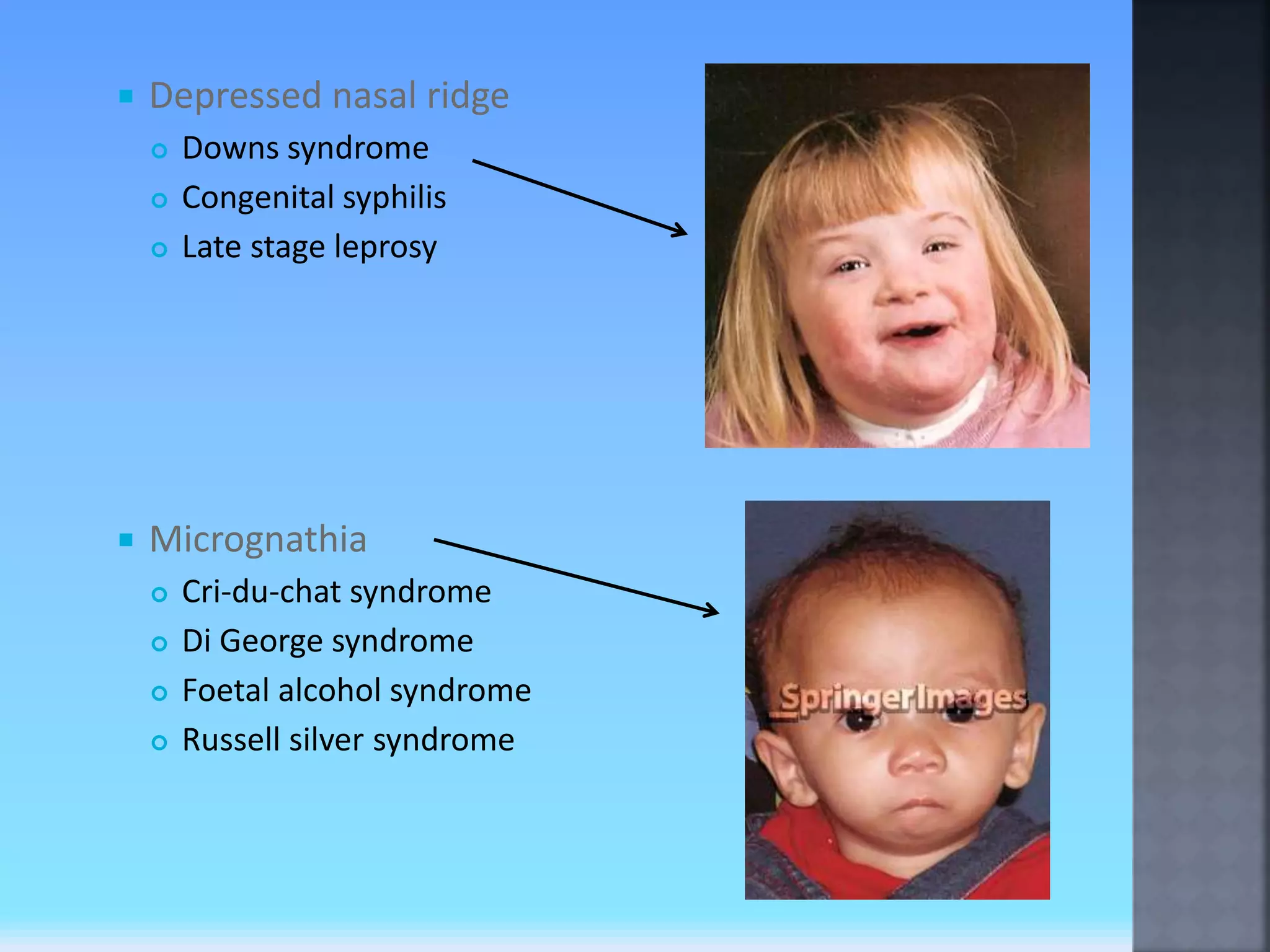 Head to foot examination in Paediatrics | PPTX