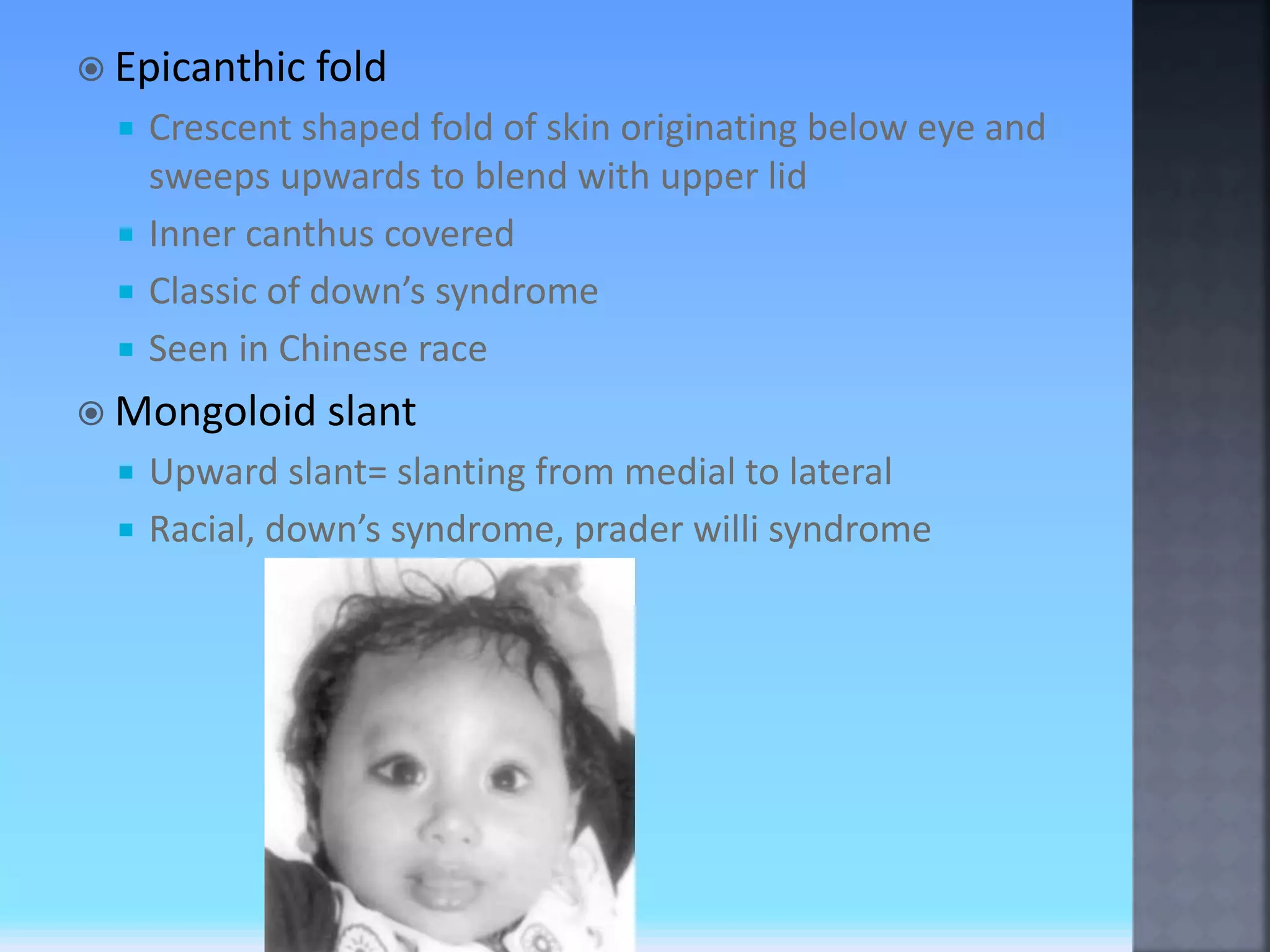 Head to foot examination in Paediatrics | PPTX