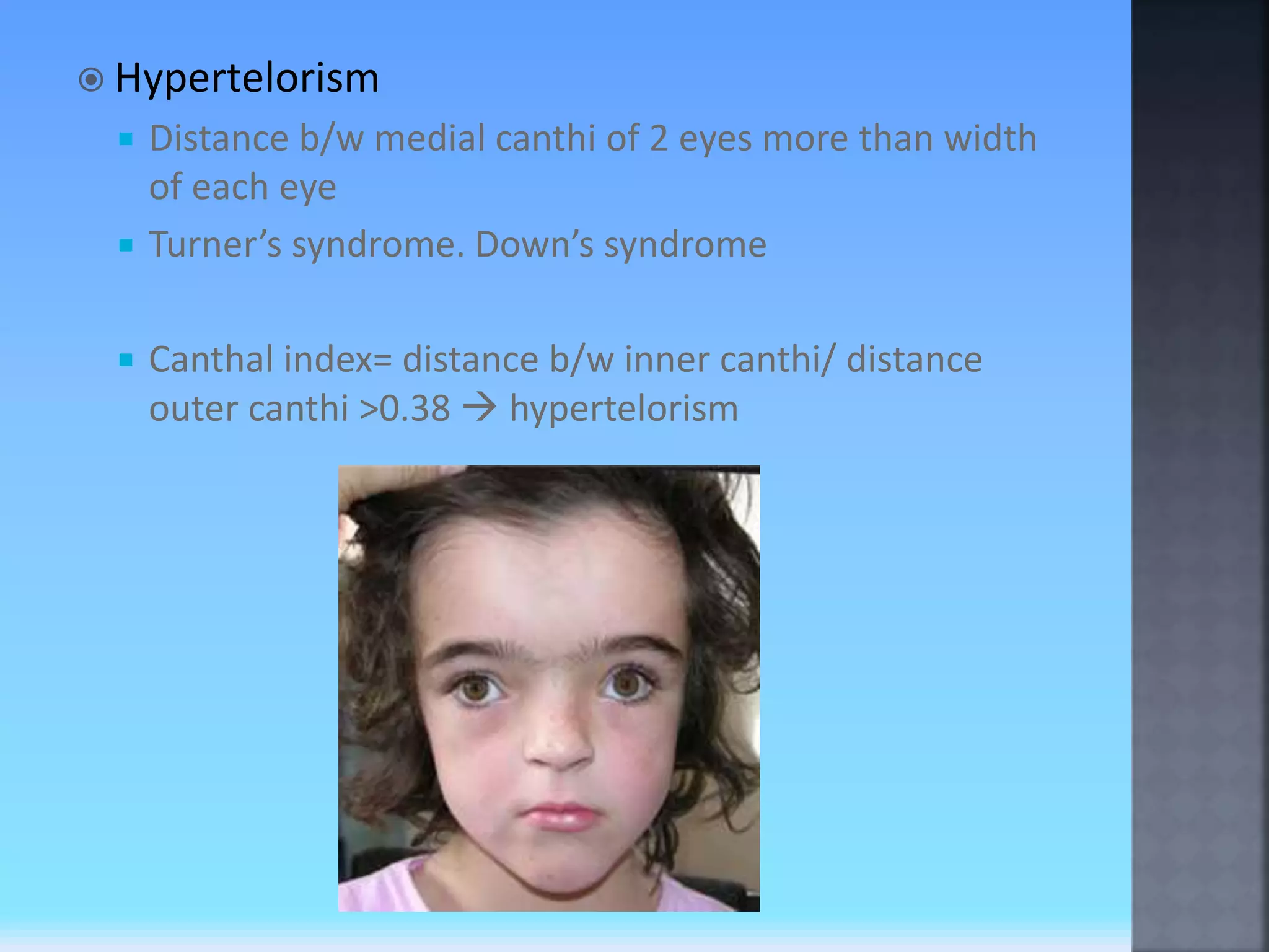 Head to foot examination in Paediatrics | PPTX