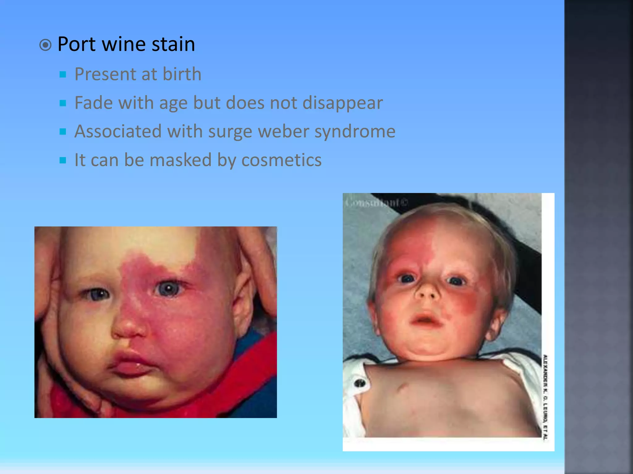 Head to foot examination in Paediatrics | PPTX