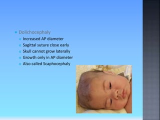 Head to foot examination in Paediatrics | PPTX