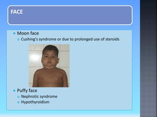 Head to foot examination in Paediatrics | PPTX