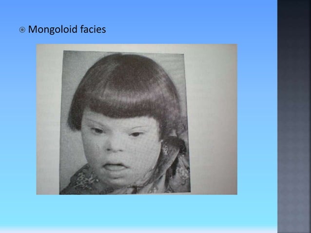 Head to foot examination in Paediatrics | PPTX