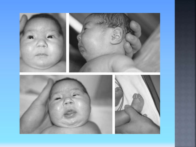 Head to foot examination in Paediatrics | PPTX