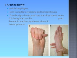 Head to foot examination in Paediatrics | PPTX