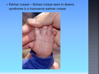 Head to foot examination in Paediatrics | PPTX