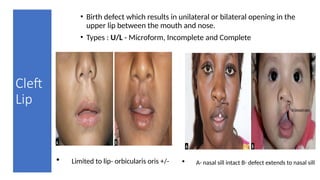 HEAD TO TOE EXAMINATION OF NEWBORNS.pptx