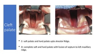 HEAD TO TOE EXAMINATION OF NEWBORNS.pptx