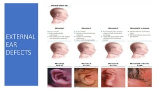 HEAD TO TOE EXAMINATION OF NEWBORNS.pptx