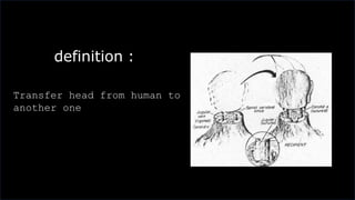 Head Transplant | PPTX
