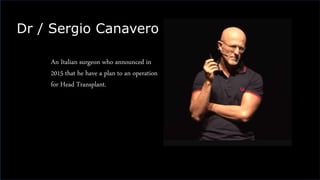 Head Transplant | PPTX