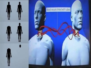 Head transplant | PPTX