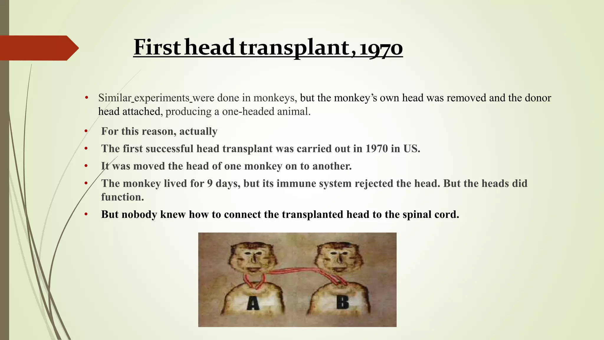 Head transplantation | PPTX