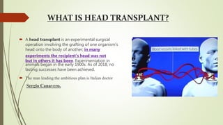 Head transplantation | PPTX