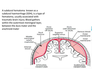 Head trauma | PPTX