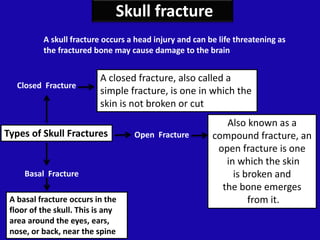 Head trauma | PPTX