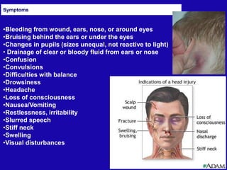 Head trauma | PPTX