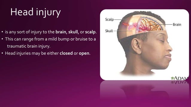 Head trauma | PPT