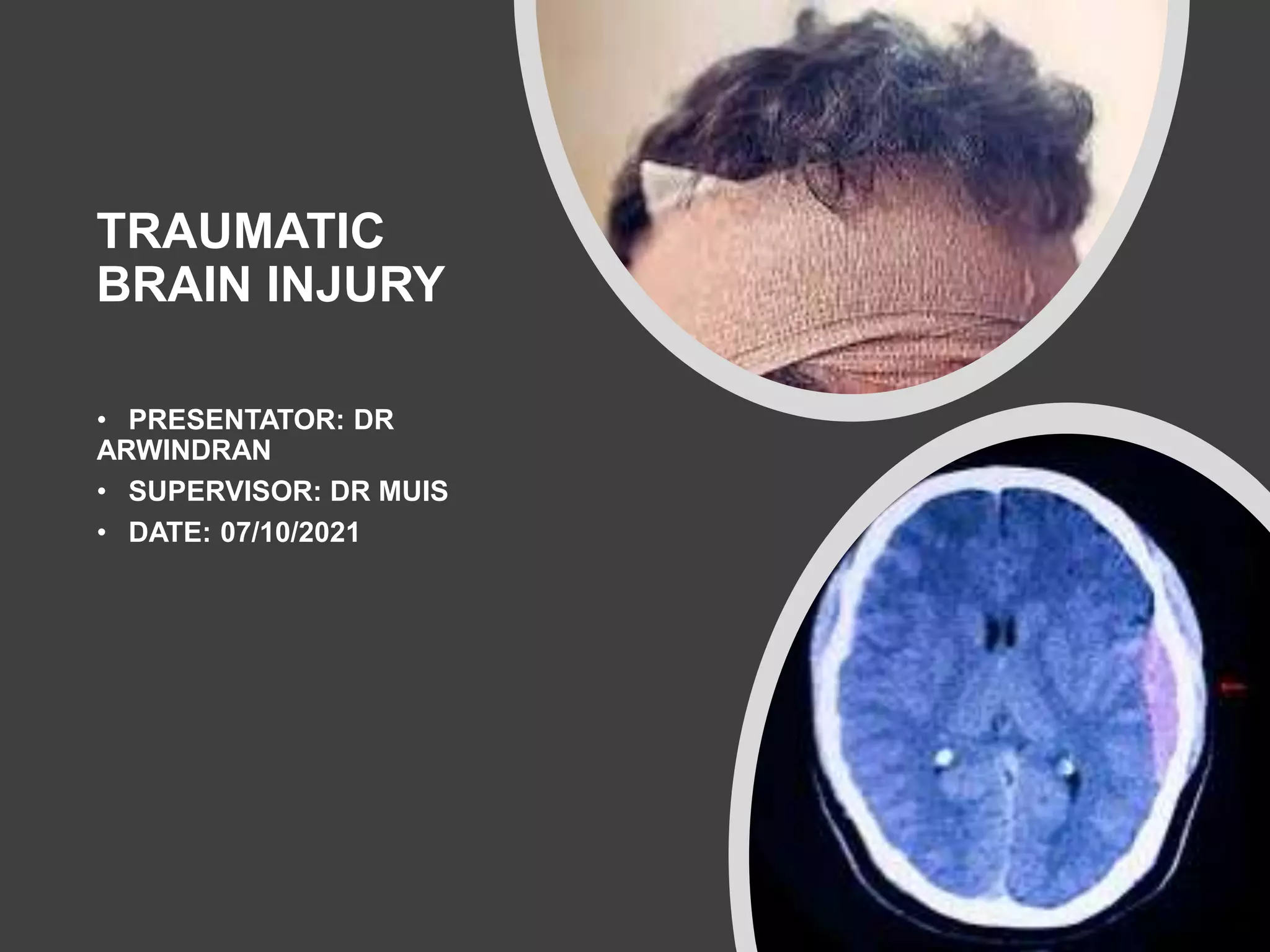 HEAD TRAUMA & CEREBRAL RESUSCITATION copy.pptx