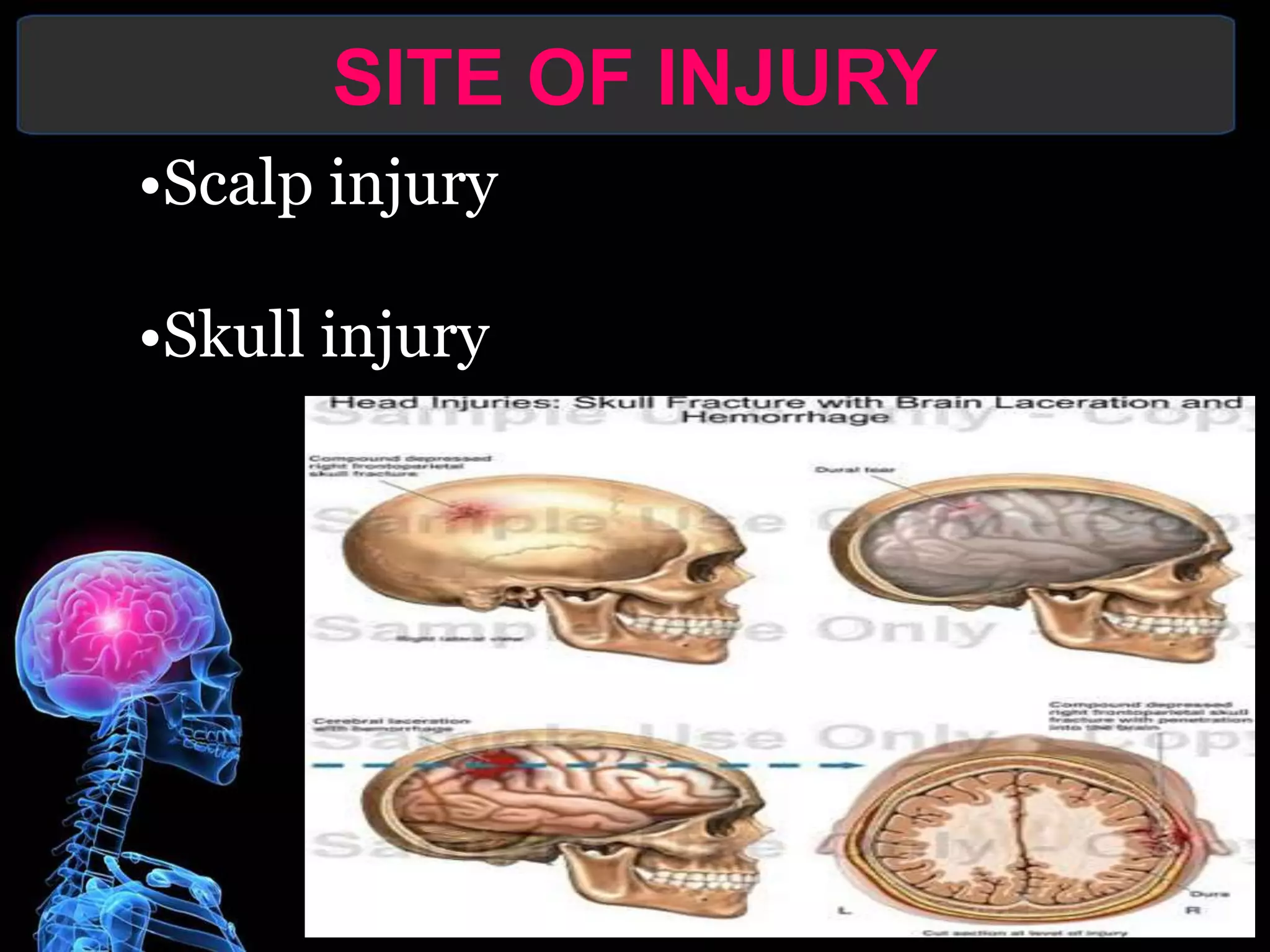 HEAD TRAUMA & CEREBRAL RESUSCITATION copy.pptx