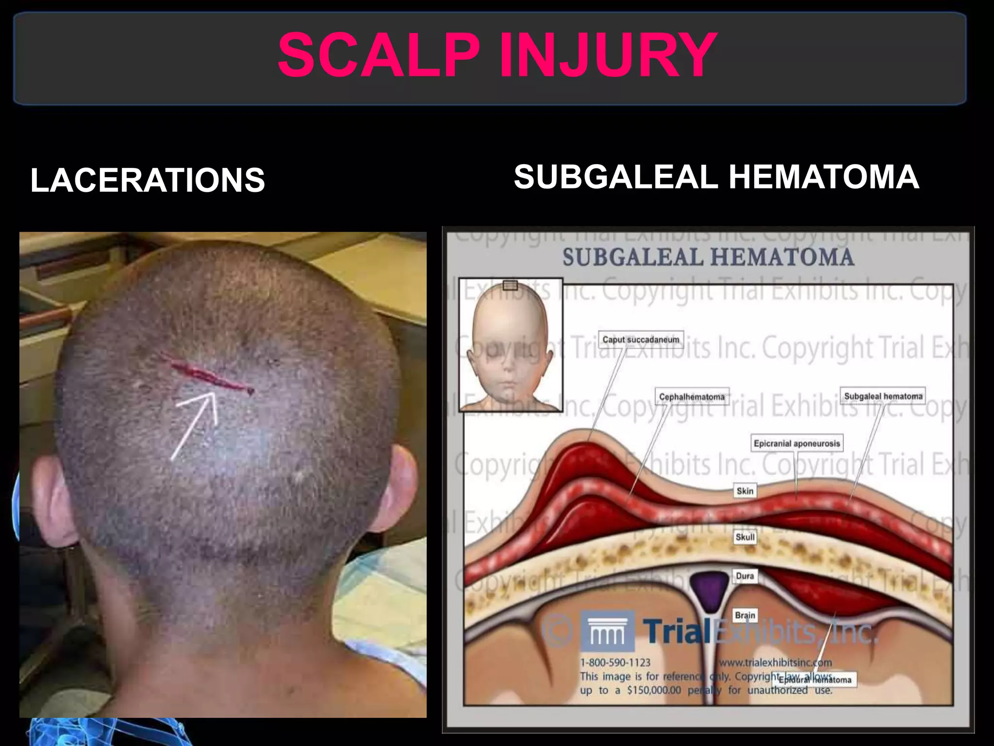 HEAD TRAUMA & CEREBRAL RESUSCITATION copy.pptx