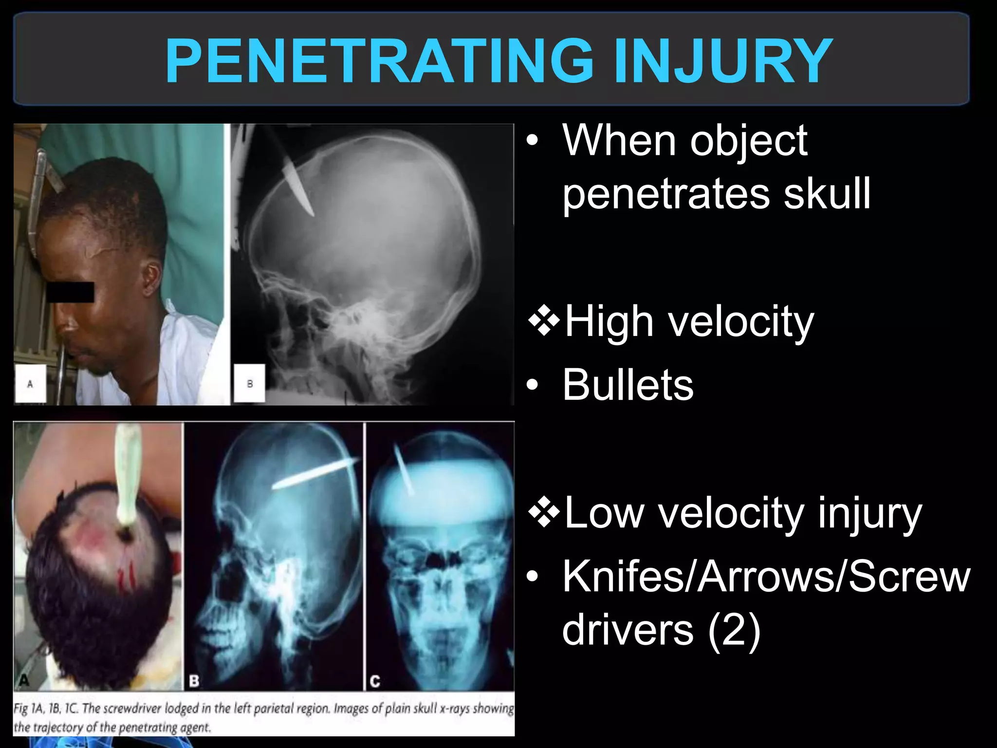HEAD TRAUMA & CEREBRAL RESUSCITATION copy.pptx