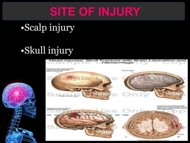 HEAD TRAUMA & CEREBRAL RESUSCITATION copy.pptx