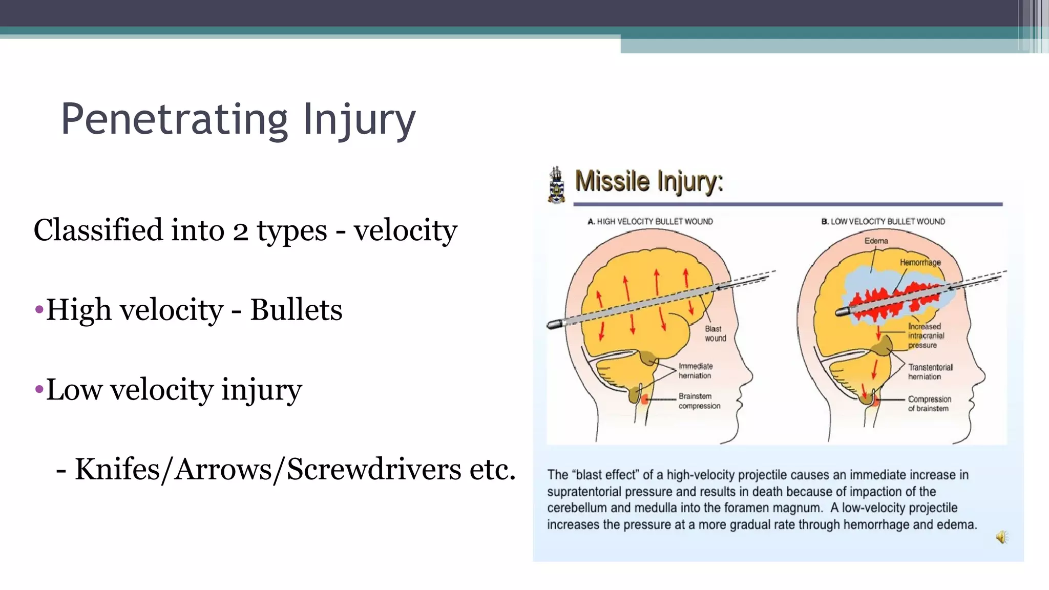 Head trauma & Management | PPT