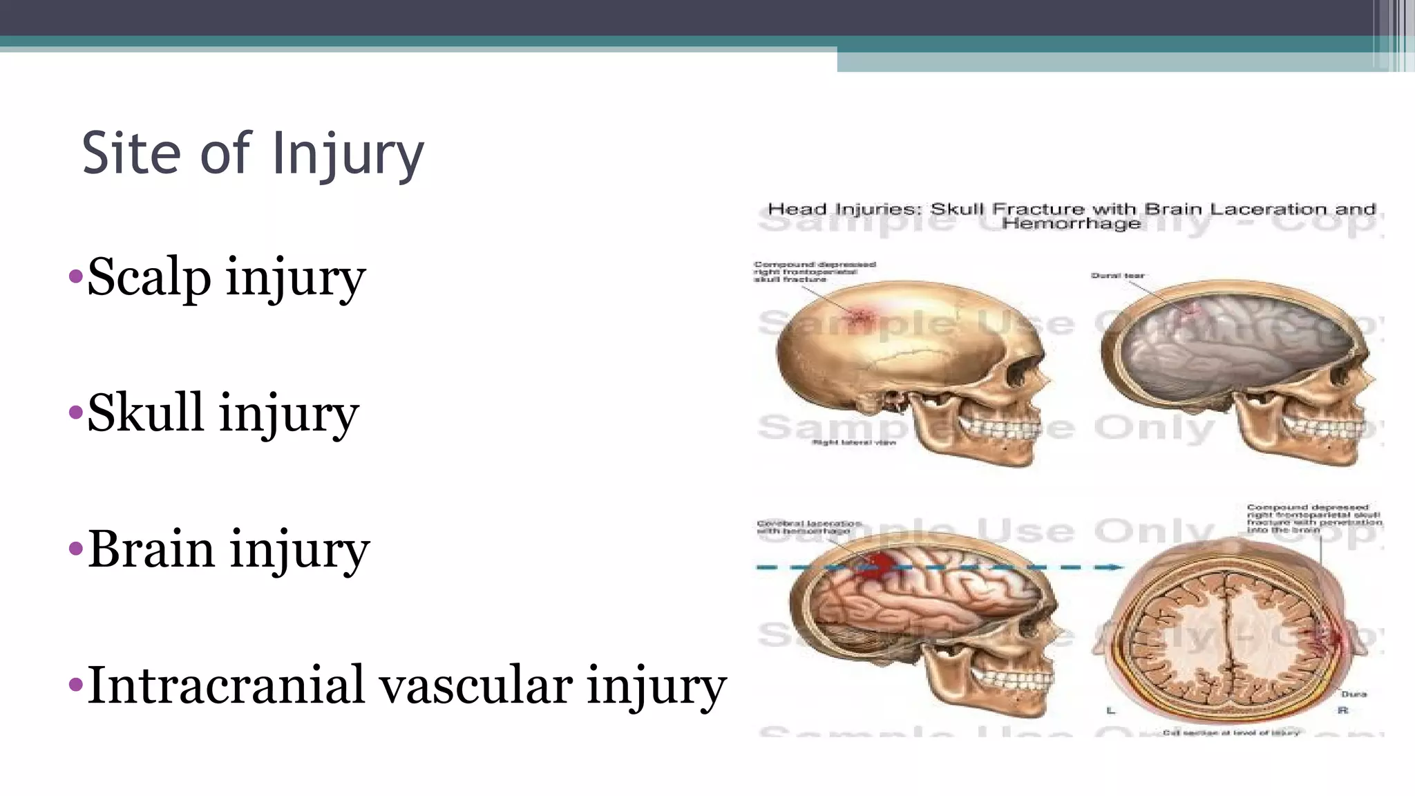 Head trauma & Management | PPT | Death, Injury, or Military Conflict ...