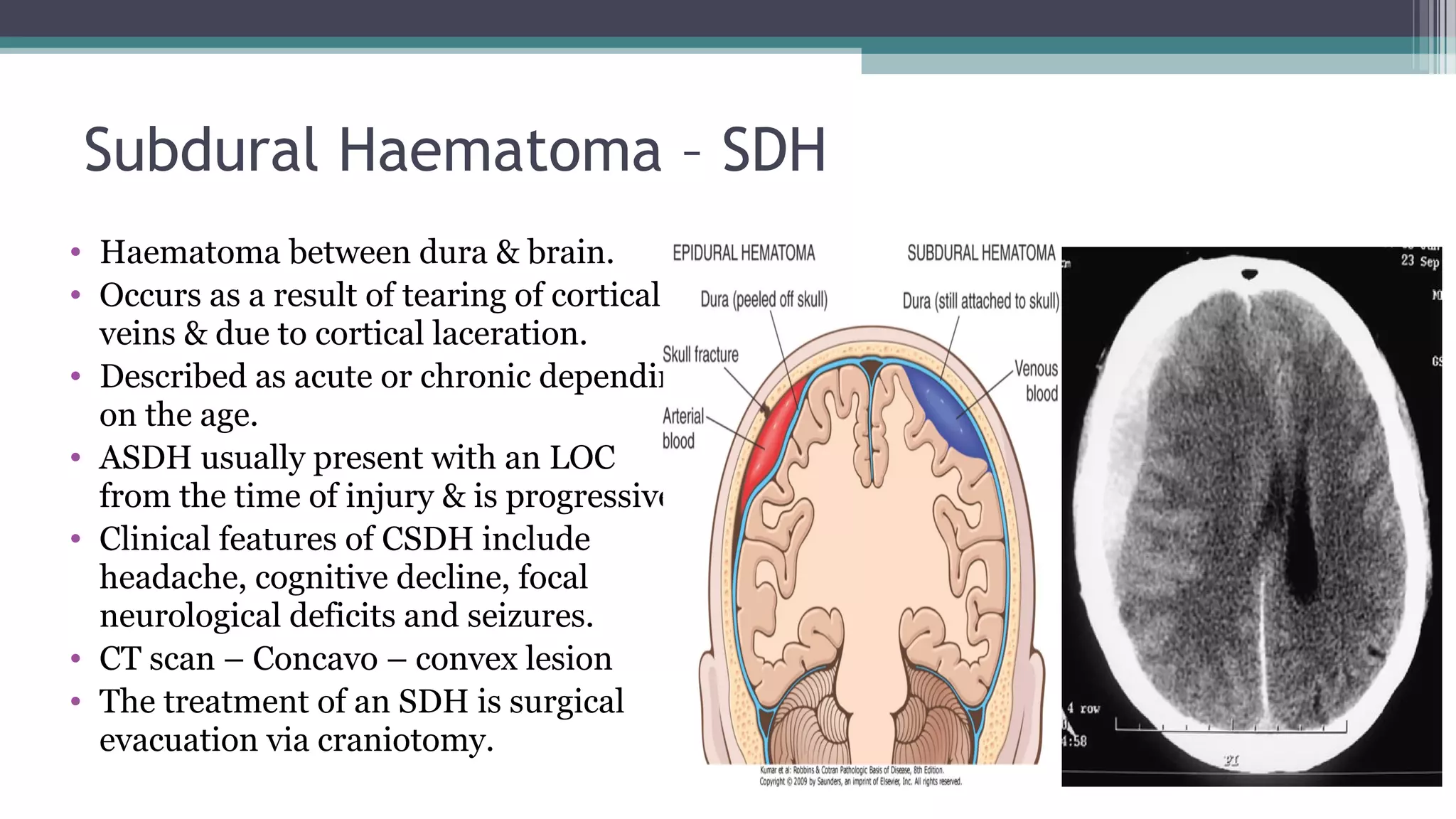 Head trauma & Management | PPT