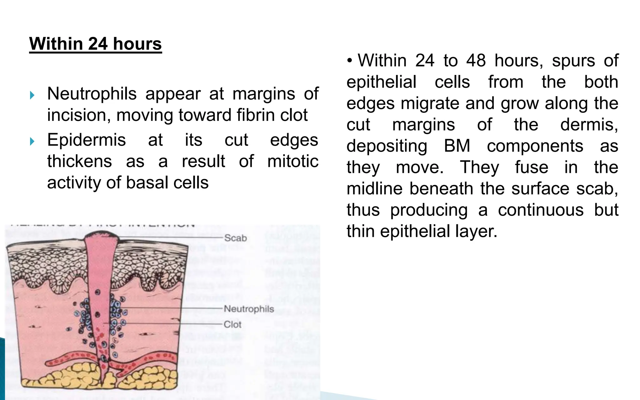 wound healing and healing of dental traumas.pptx