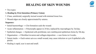 Mechanism of Healing and factors influencing wound healing.pptx