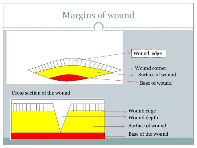 Healing of-oral-wounds - copy
