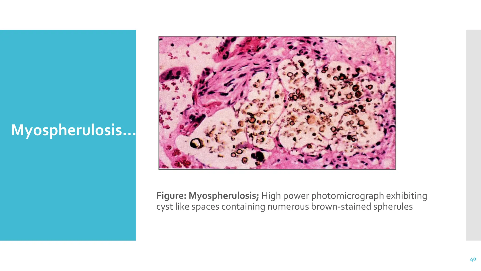 healing of extraction socket power point presentation | PPTX