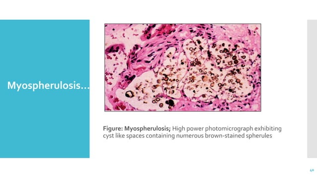 healing of extraction socket power point presentation | PPTX | Dental ...