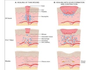Healing and repair | PPTX