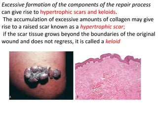 Healing and repair | PPT