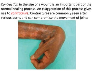 Healing and repair | PPT